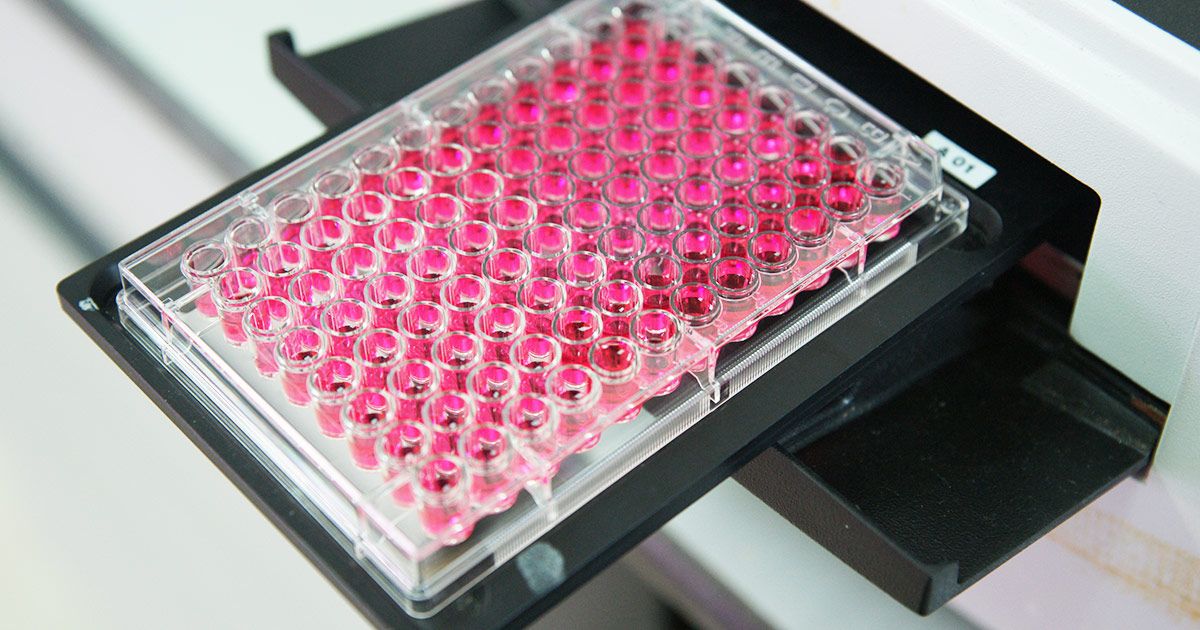 Monocyte Activation Test Batch Release Testing | MAT BioTech | MAT BioTech